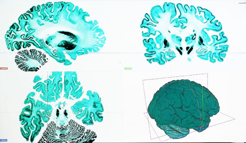 Research – McGill Centre for Integrative Neuroscience