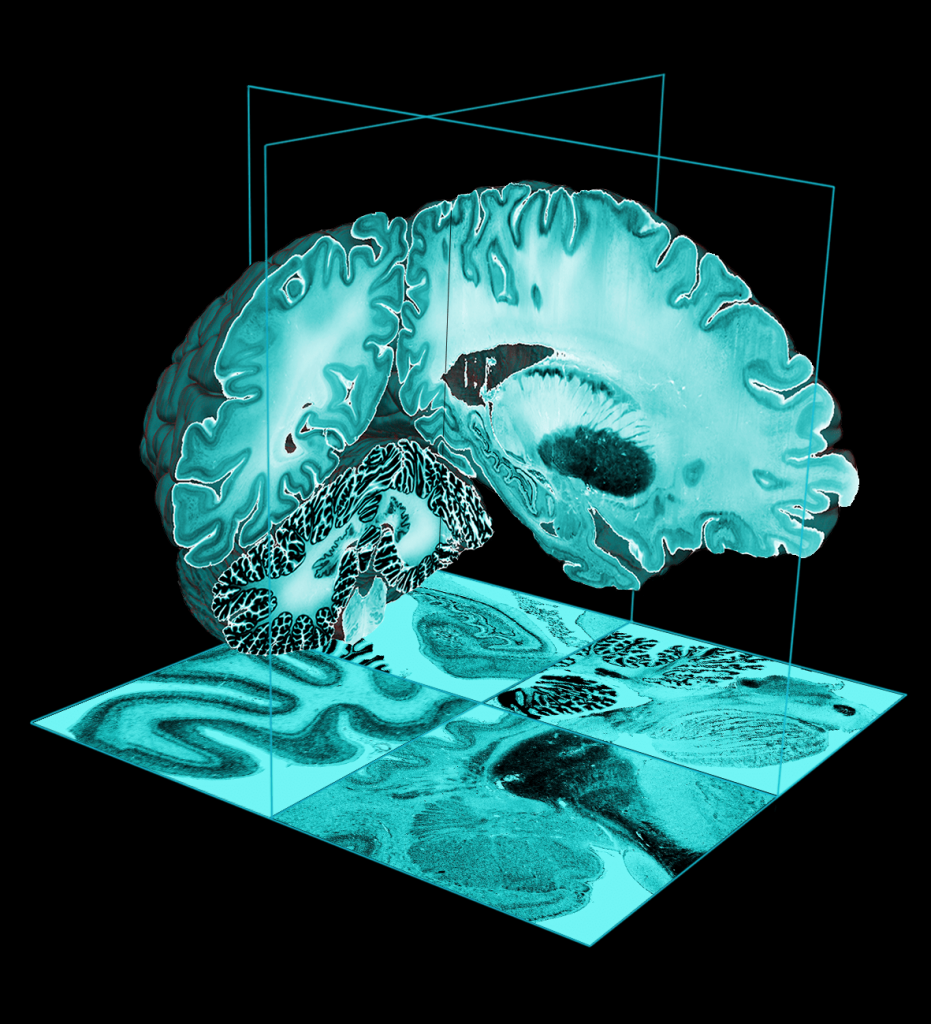 Atlases – McGill Centre for Integrative Neuroscience
