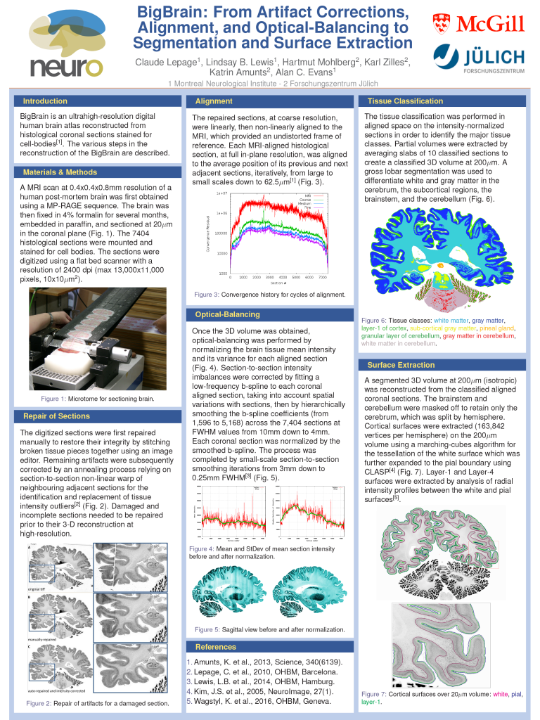 Posters – McGill Centre for Integrative Neuroscience