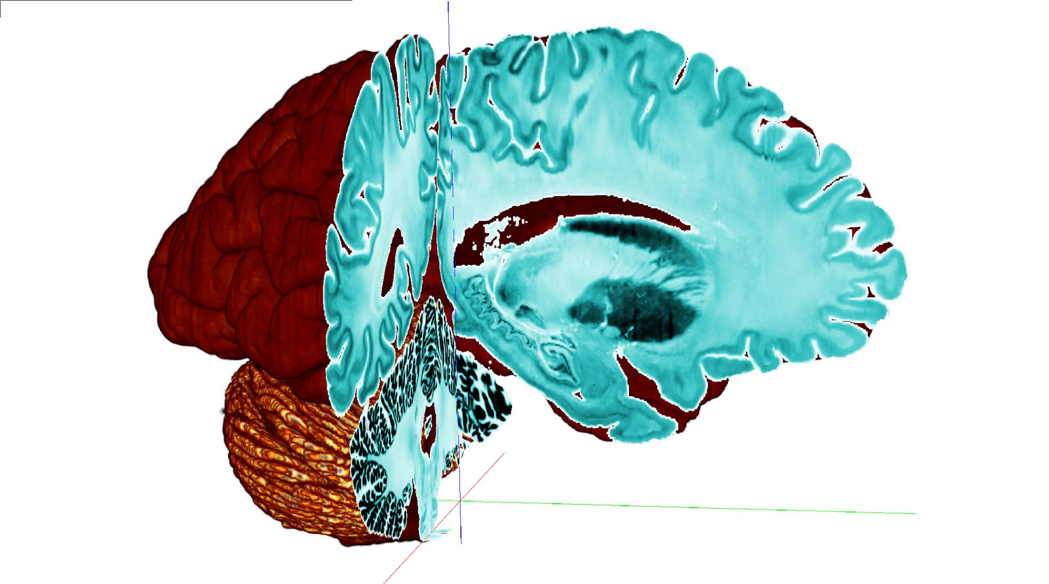 The BigBrain Project – mcin.ca